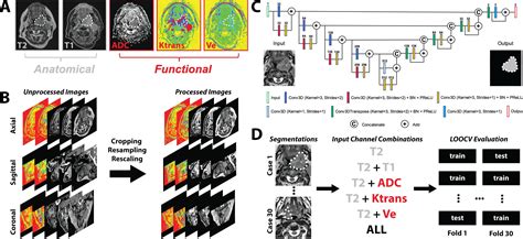 Evaluation Of Deep Learning Based Multiparametric Mri Oropharyngeal