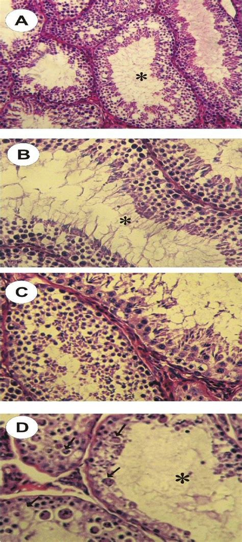 Photomicrographs Of Testicular Sections From Control And Download