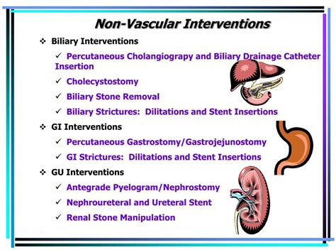 Ppt Interventional Radiology Powerpoint Presentation Free Download