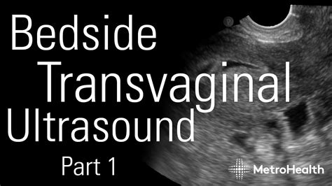 Bedside Transvaginal Ultrasound Part 1 Youtube