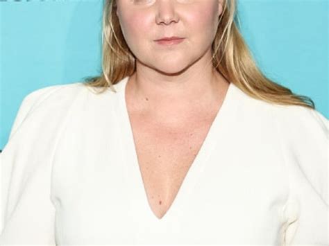 Actriz Amy Schumer Revela Que Padece El Síndrome De Cushing Pide