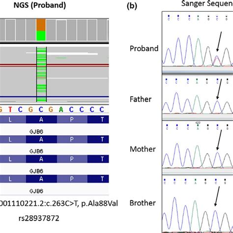 A Targeted Next Generation Sequencing Ngs Identified The Mutation
