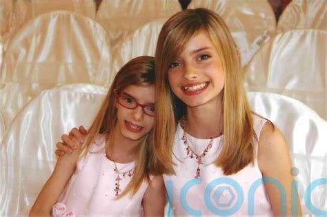 Worlds Only Identical Twin With Primordial Dwarfism Lifts The Lid On