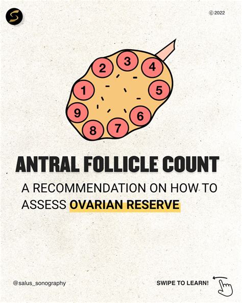 Fertility Testing 101 What Is An Antral Follicle Count 52 Off