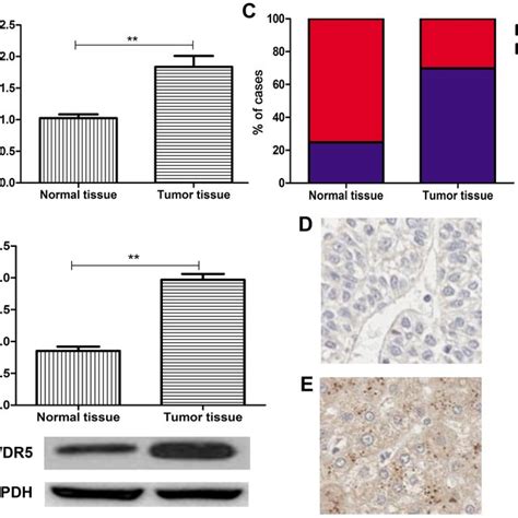 Wdr5 Expression Was Significantly Elevated In Hcc Cell Lines A