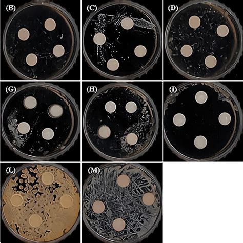 Representative Photography For Pathogenic And Nonpathogenic Bacterial