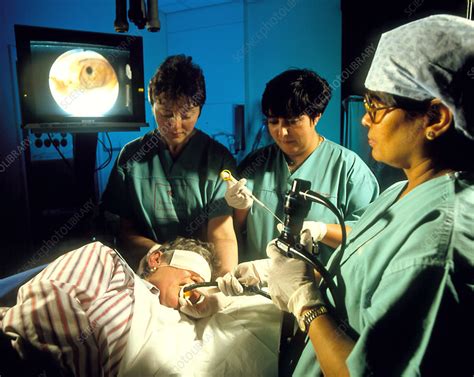 Endoscope Examination And Biopsy Of The Stomach Stock Image M440 0145