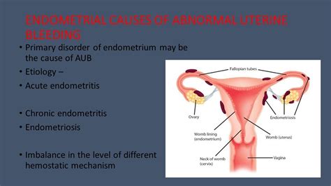 Ovulatory Dysfunction And Endometrial Causes Of Abnormal Uterine