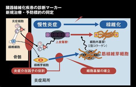 病的な線維化が起こる機序 高橋医院