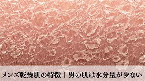 【メンズ必見！】乾燥肌の原因と効果的な対策をご紹介！顔や全身のカサカサを抑えるには？│メンズ美容塾 By Bulk Homme