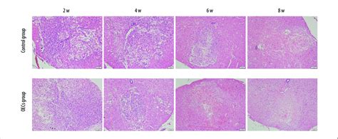 Hematoxylin And Eosin He Staining Of Lesion Site He Staining