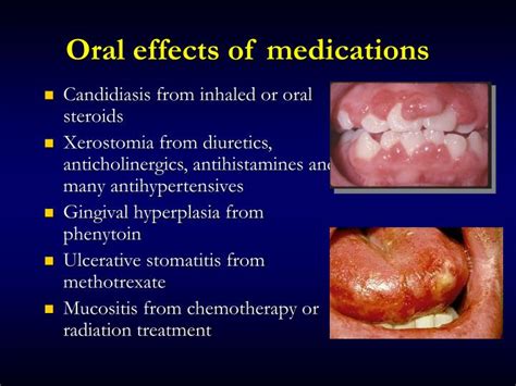 Ppt Oral Manifestations Of Systemic Diseases Powerpoint Presentation