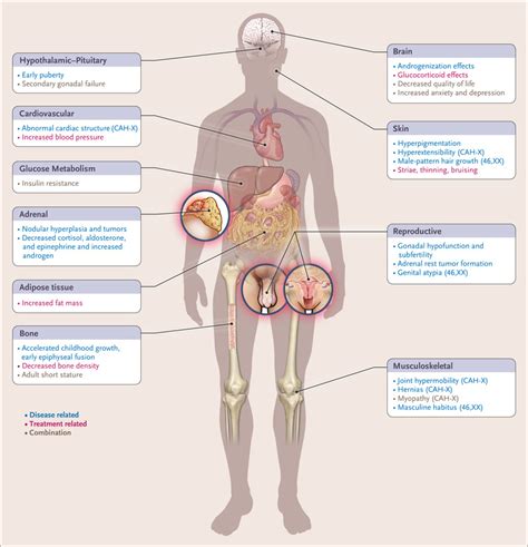 Congenital Adrenal Hyperplasia