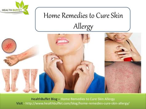 Home Remedies To Cure Skin Allergy
