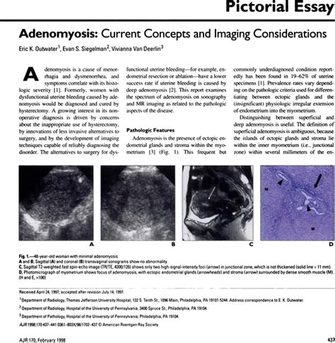 Adenomyosis Current Concepts And Imaging Considerations Ajr