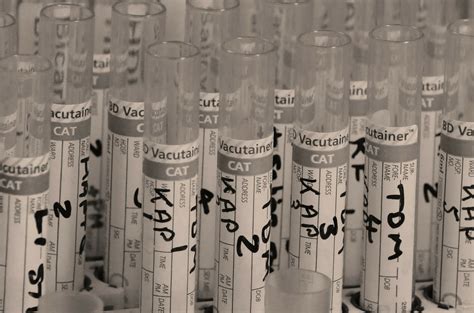 Apd Still Years Away From Clearing Dna Backlog Austin Monitoraustin