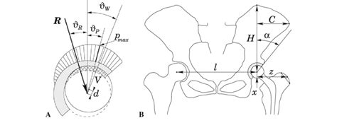 A B A A Schematic View Of The Acetabular Cup Shows Penetration Of The