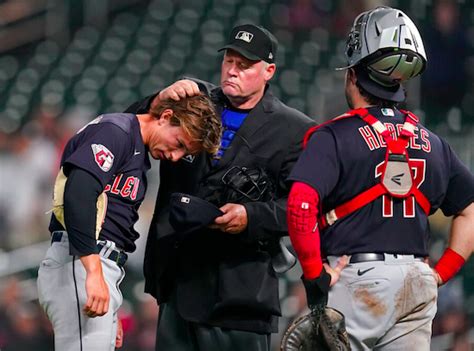 Mlb Pitcher Accused Of Cheating Via Sticky Stuff In His Hair Av24
