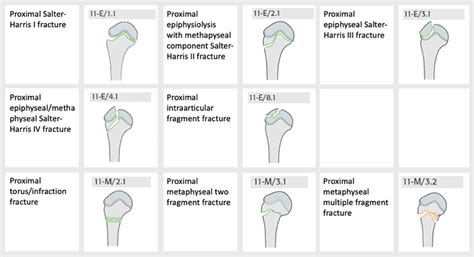 Fracture Classification According To The Ao Ota Classification System