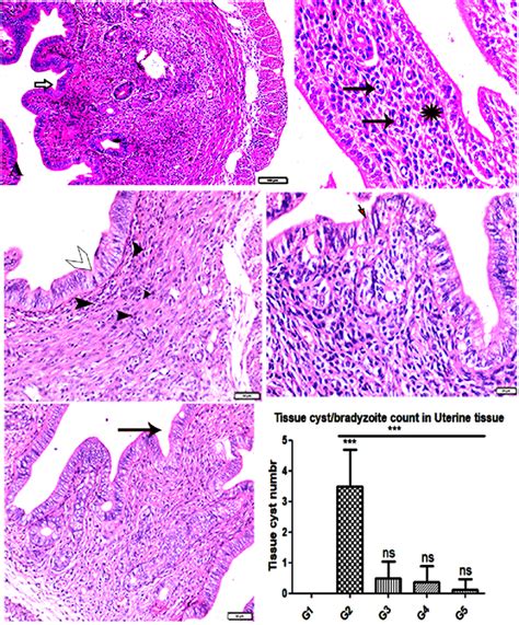 Photomicrograph Of Uterine Tissue Sections From Mice Of Experimental
