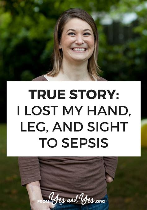 True Story I Lost My Hand Leg And Sight To Sepsis In 2021 True