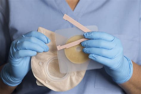 British Journal Of Community Nursing The Community Nurse And Stoma Care