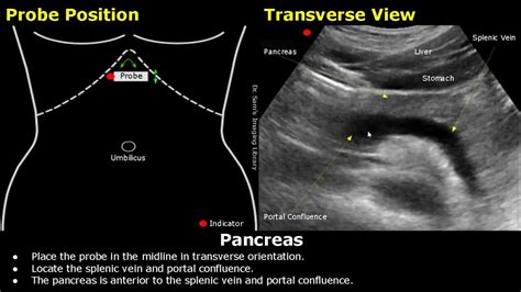 Pancreas Ultrasound Probe Positioning Transducer Placement And Scanning