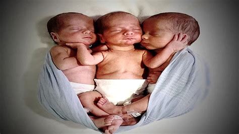 Young Mom Gives Birth To Triplets Doctor Freezes When He Sees Faces