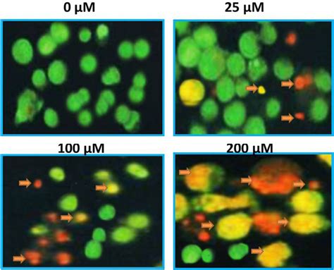 Results Of Ao Eb Staining Assay Showing Normal Cells In Controls And