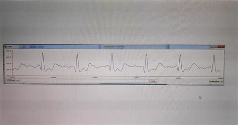 Ecg Signal Output Album On Imgur