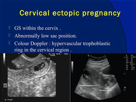 Early Pregnancy Ultrasonographic Evaluation