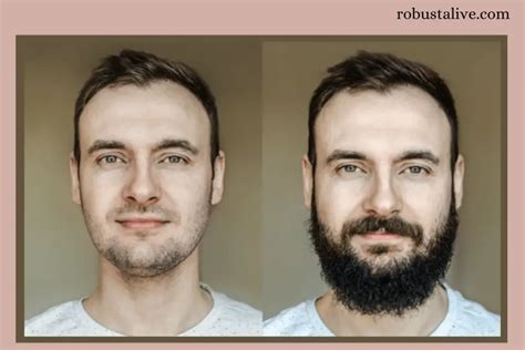 Will Testosterone Help Grow A Beard Robustalive