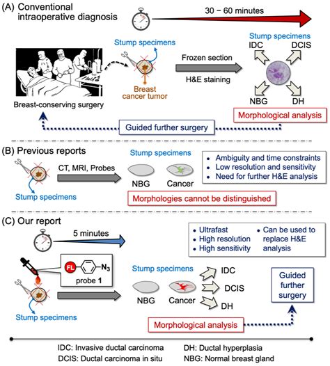 Tumor Detection During Breast Cancer Surgery It Aint Magic