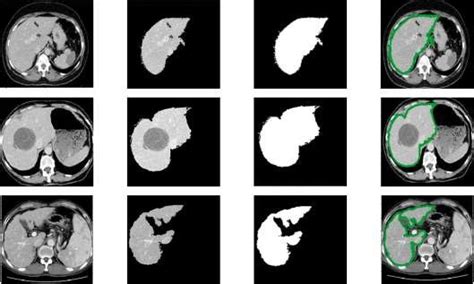 Liver Segmentation Results A Original Input Abdomen Scan B