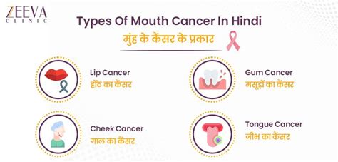Mouth Cancer Symptoms In Hindi Muh Ka Cancer हिंदी में 2023 Zeeva