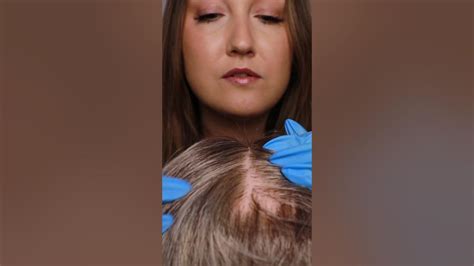 Asmr Relaxing Hair And Scalp Treatment Youtube