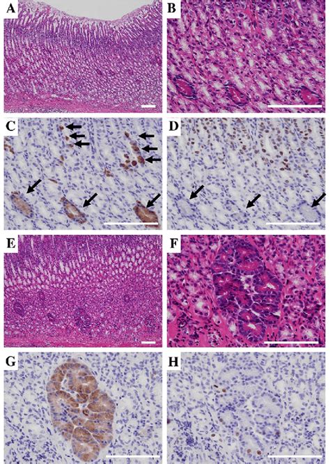 Hematoxylin And Eosin He Staining And Immunohistochemical Staining Of