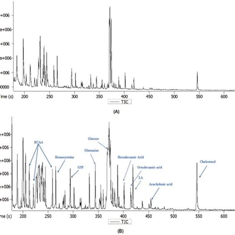 Typical Gc Tof Ms Total Ion Chromatograms Of Rat Plasma Obtained From
