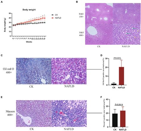 The Body Weight And Histopathology With Control And Nafld Mice A