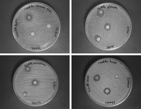 Typical Agar Plates Showing The Growth Inhibition Zones By Calendula