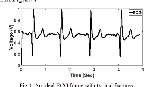 Figure 1 From Heartbeat Pattern Classification Algorithm Based On
