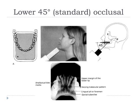 Radiographic Assessment In Paediatric Dentistry Ppt