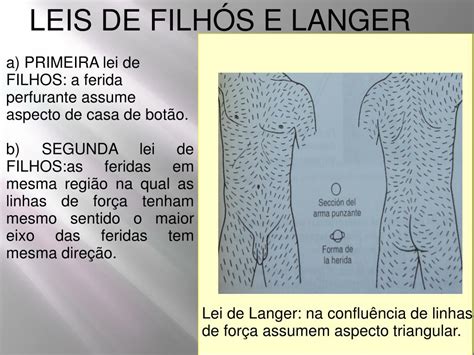 Ppt Exemplos De Morte Por Causa Não Natural Powerpoint Presentation
