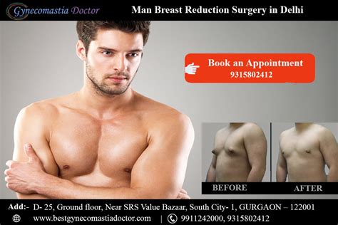 Male Breast Reduction Surgery In East Delhi India By Gynecomastia