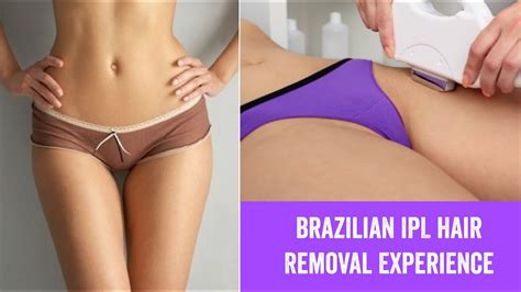 My Brazilian Ipl Hair Removal Experience Youtube