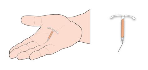 intra uterine system ius lish