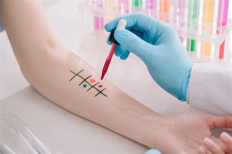 Allergy Skin Test Everything You Need To Know Dr Amy Schiffman Md