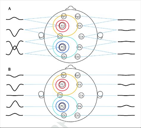 Schematic Representation Of Eeg Traces Recorded From A Signal Generated