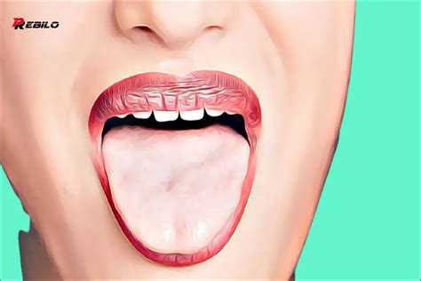 What Does Your Tongue Say About Your Health