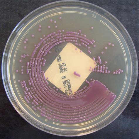 Ndm 1 Escherichia Coli On Chromid Cps Agar Escherichia Col… Flickr